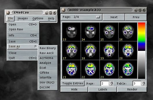 (X)MedCon | Docs / ProgramGUI